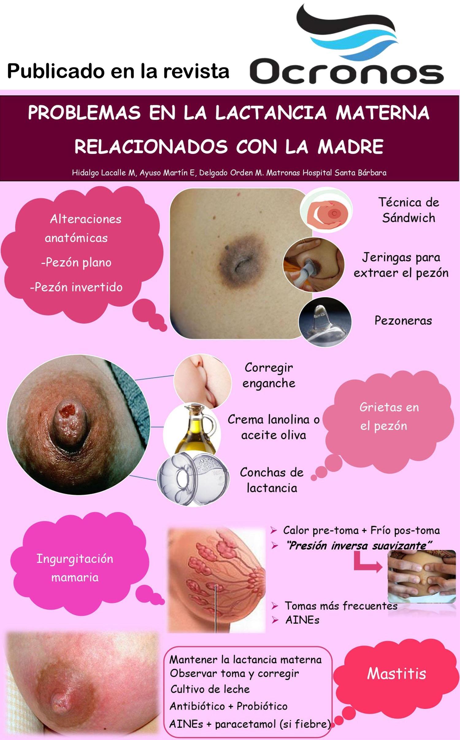 Guía Completa sobre los Tipos de Pezón y la Lactancia Materna